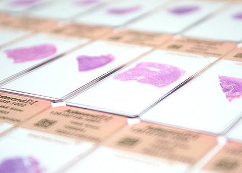 BioIVT - Biospecimen Solutions for Your Research Needs